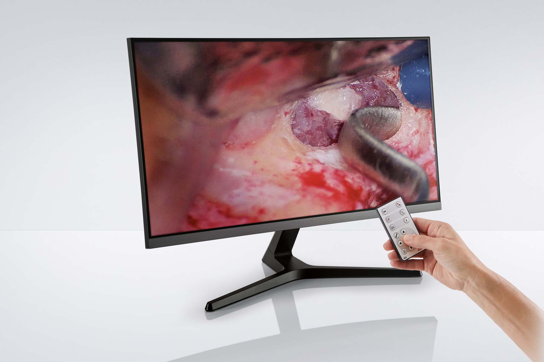 M320 D Dental Microscope | Products | Leica Microsystems