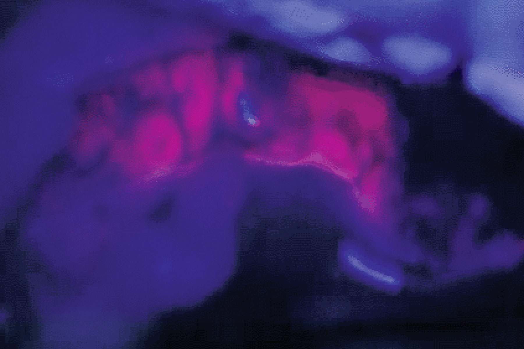 FL400 Blue Light Fluorescence Module | Products | Leica Microsystems