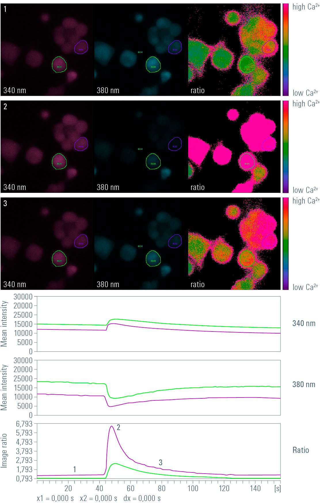 Ratiometric Imaging | Learn & Share | Leica Microsystems