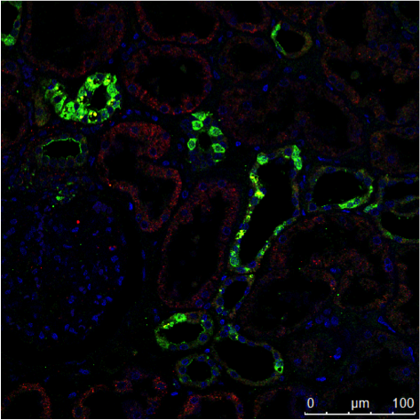 How to Prepare Your Specimen for Immunofluorescence Microscopy: Leica ...