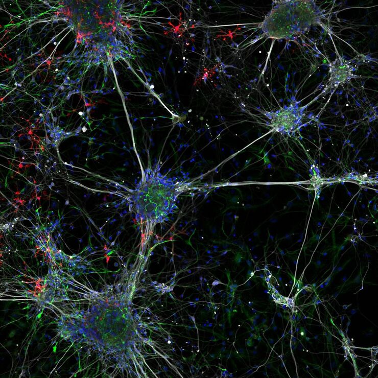 TCS SP8 X White Light Laser Confocal Microscope - Media | Products ...