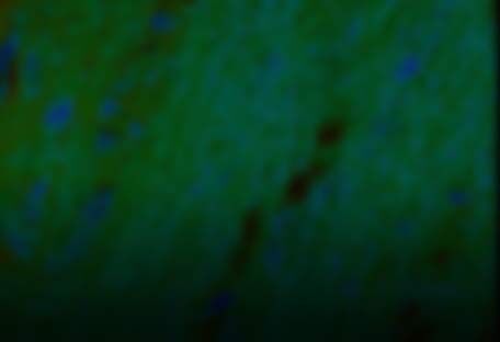 STELLARIS CRS Coherent Raman Scattering Microscope | Products | Leica ...