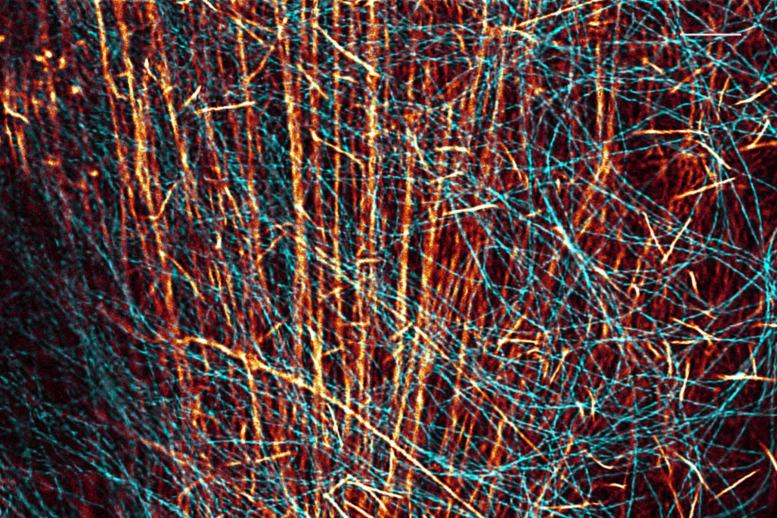 Microscopios STELLARIS STED | Productos | Leica Microsystems