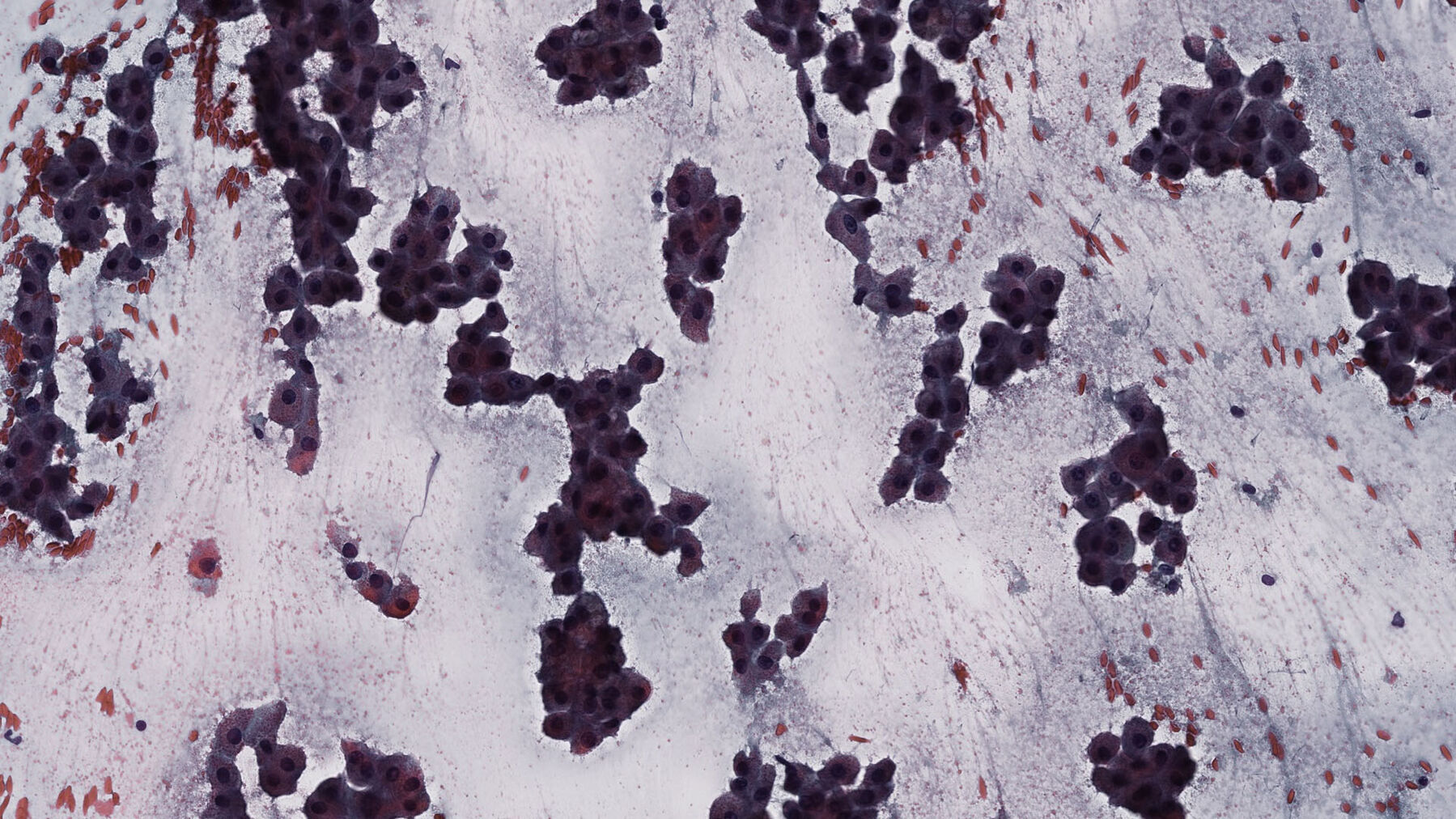 Anatomic Pathology | Applications | Leica Microsystems