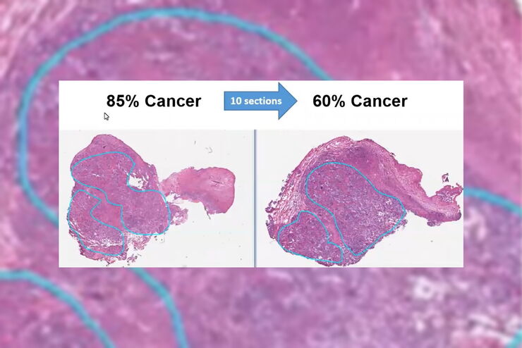 Leica LMD6 & LMD7 LMD | Objetivos adicionales recomendados ...