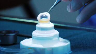 Cornea Surgery | Applications | Leica Microsystems
