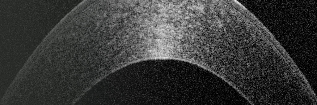 Ophthalmology | Applications | Leica Microsystems