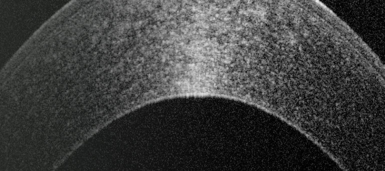 Ophthalmology | Applications | Leica Microsystems