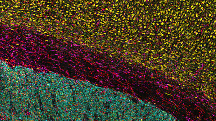 THUNDER Imager Cell Spinning Disk | Products | Leica Microsystems