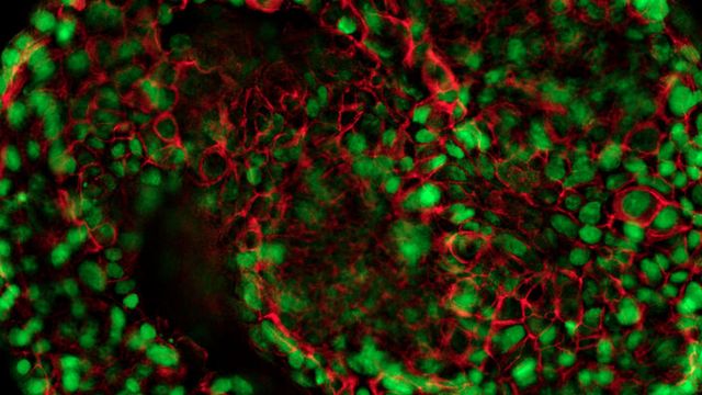 Confocal Microscopes | Products | Leica Microsystems