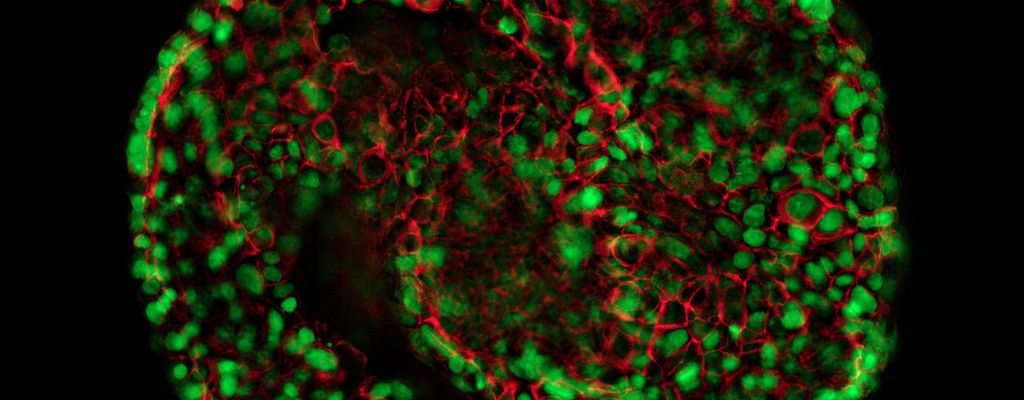 SP8 LIGHTNING Confocal Microscope | Products | Leica Microsystems