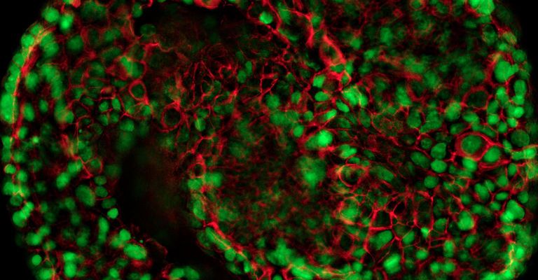 Confocal Microscopes | Products | Leica Microsystems