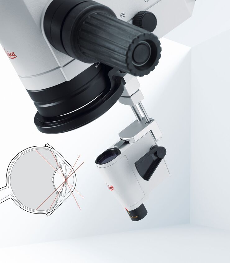 RUV800 Panoramic Viewing System for Retinal Surgery - Media | Products ...