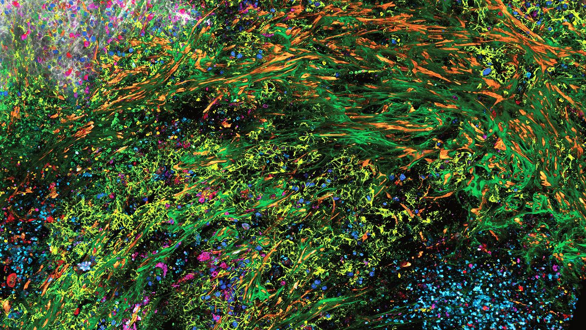 Advanced Tissue Imaging & Analysis | Applications | Leica Microsystems