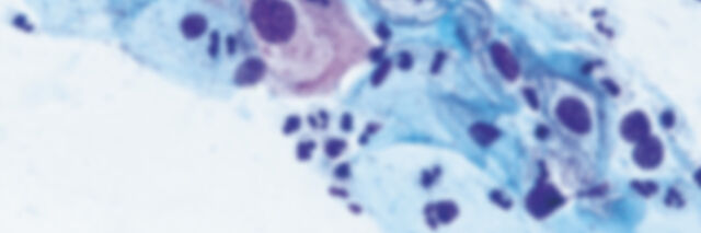 Leica DM2000 & DM2000 LED Ergonomic System Microscopes for Complex ...