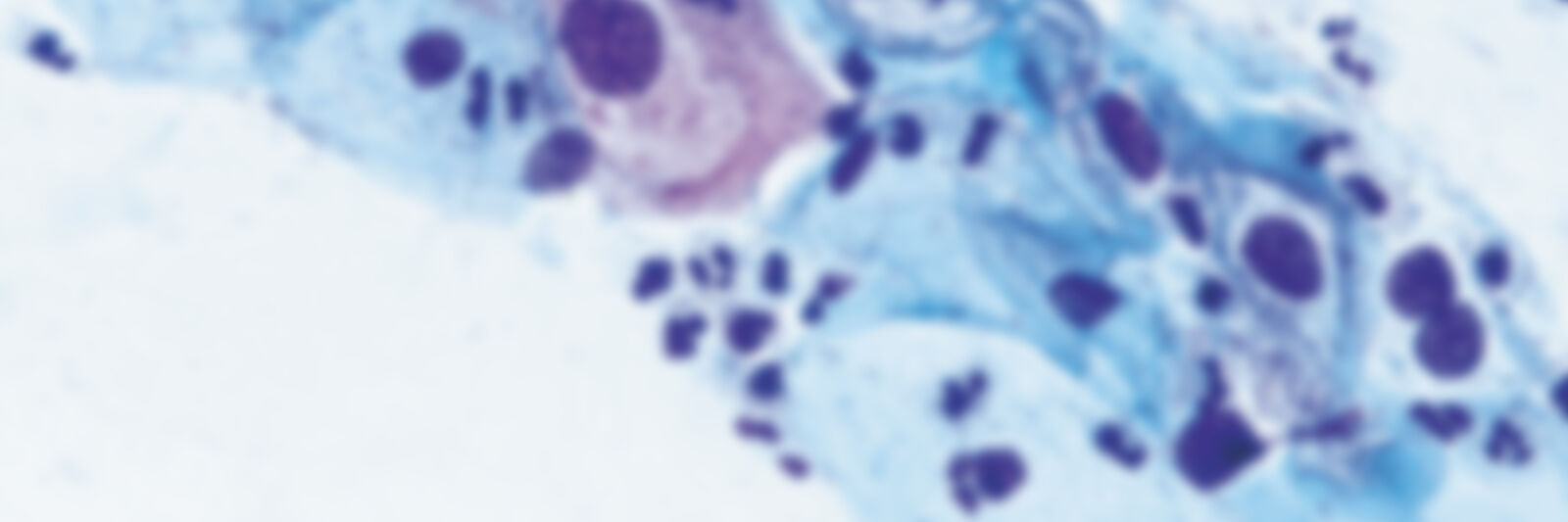 Leica DM2000 & DM2000 LED Ergonomic System Microscopes for Complex ...