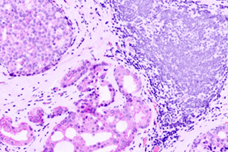 Cell DIVE Multiplex Imaging Solution | Products | Leica Microsystems