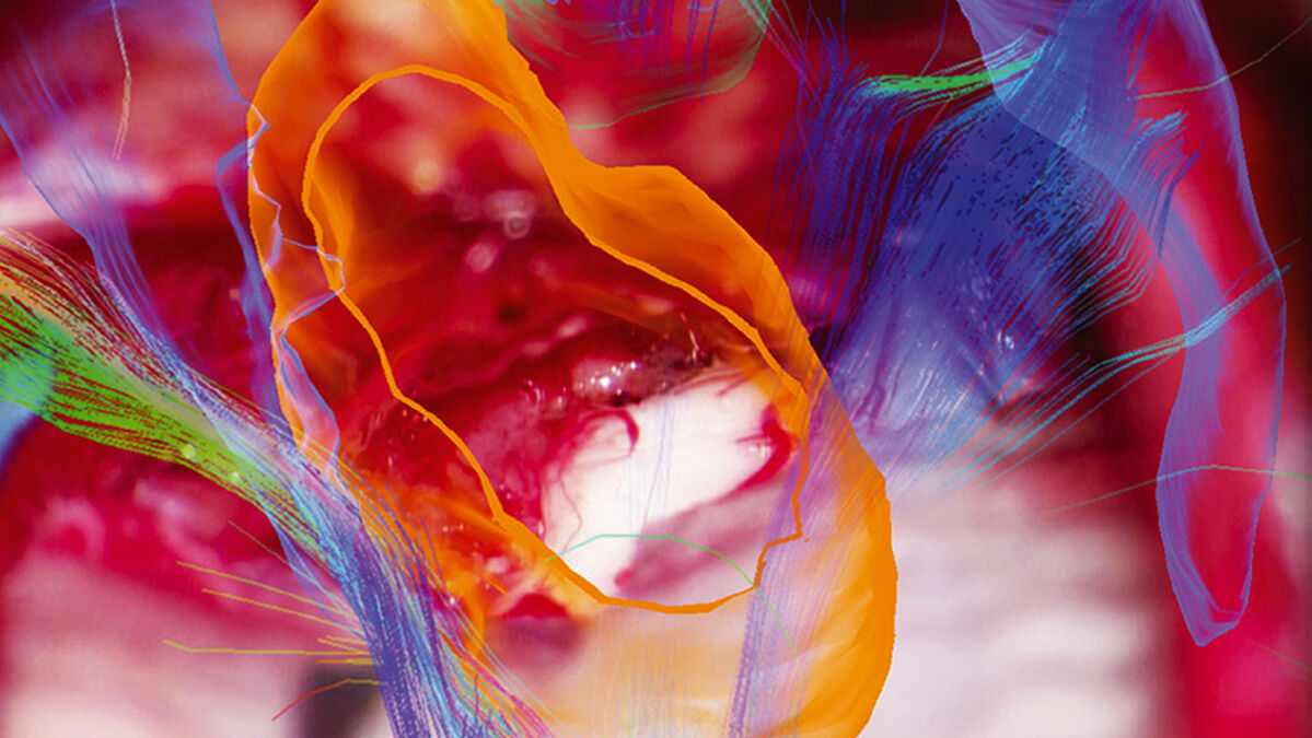 Otolaryngology (ENT) | Applications | Leica Microsystems