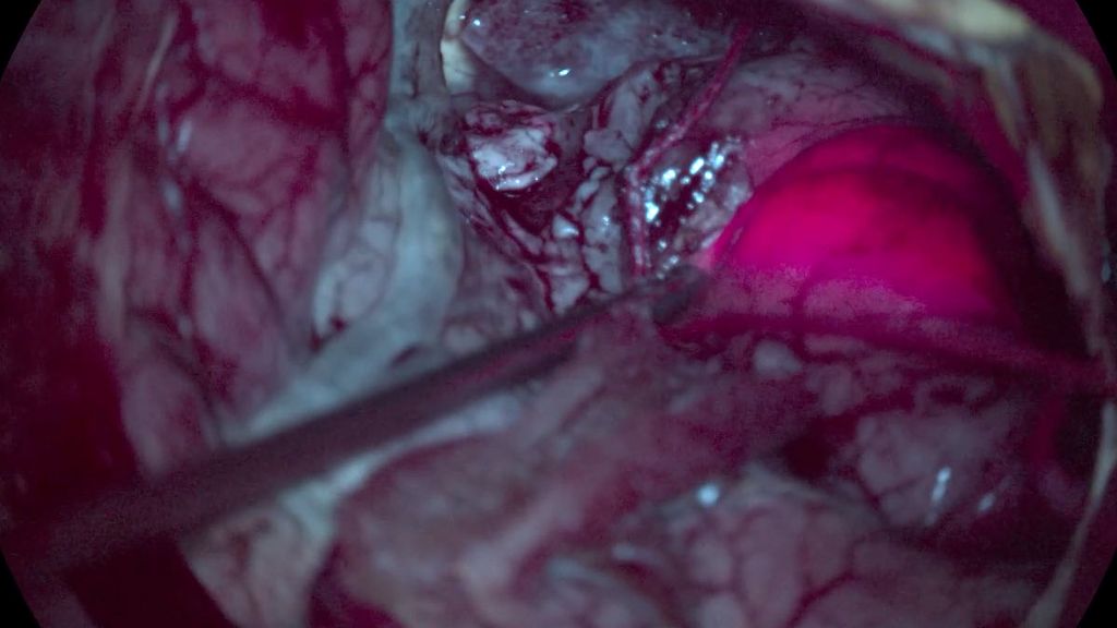 Neurovascular Surgery | Applications | Leica Microsystems