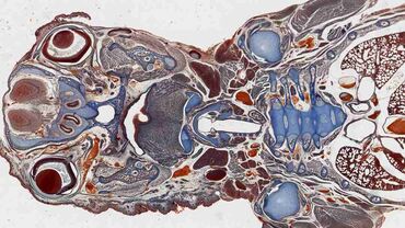 Leica DM2000 & DM2000 LED Ergonomic System Microscopes for Complex ...