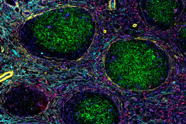 Empowering Spatial Biology with Open Multiplexing and Cell DIVE | Learn ...