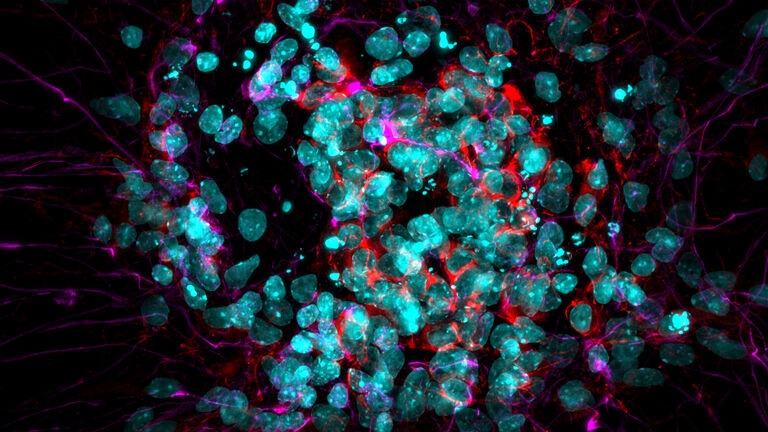 Confocal Microscopes | Products | Leica Microsystems