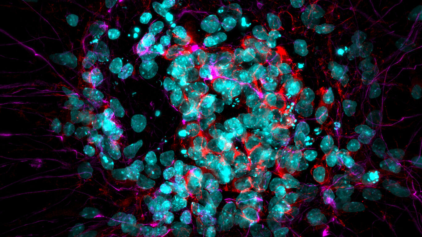 Confocal Microscopes | Products | Leica Microsystems