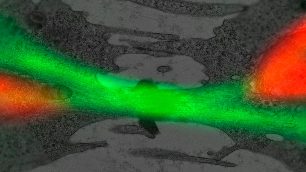 Correlative Light and Electron Microscopy (CLEM) | Applications | Leica ...