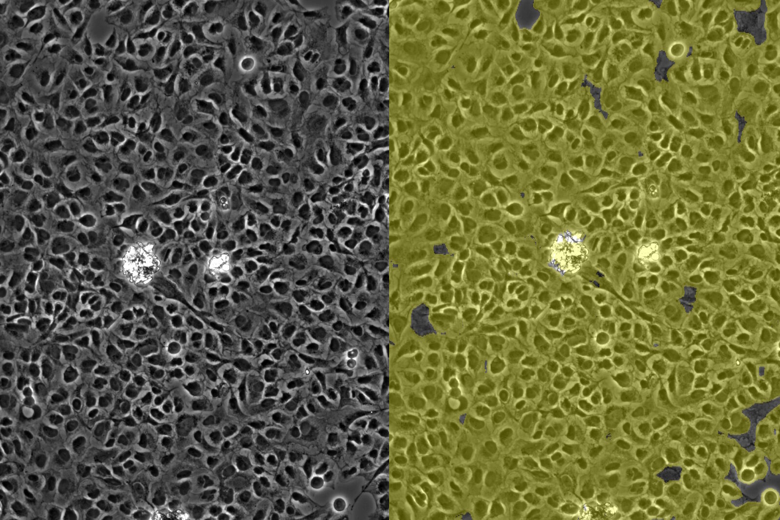 AI Confluency Analysis for Enhanced Precision in 2D Cell Culture ...