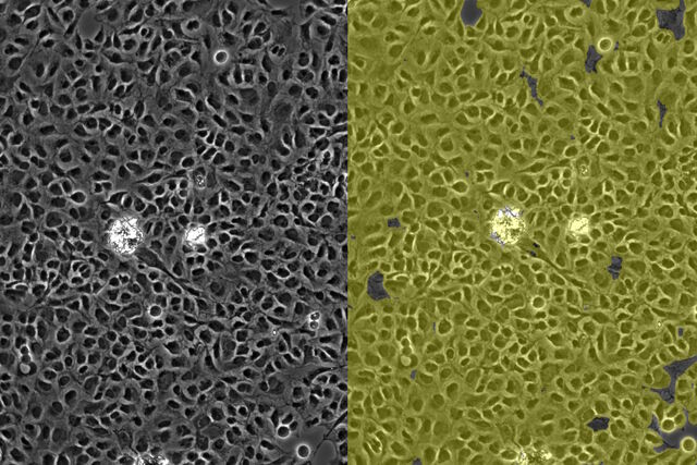 AI Confluency Analysis for Enhanced Precision in 2D Cell Culture ...