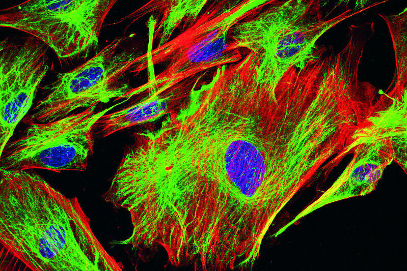Fluorescent Dyes | Learn & Share | Leica Microsystems