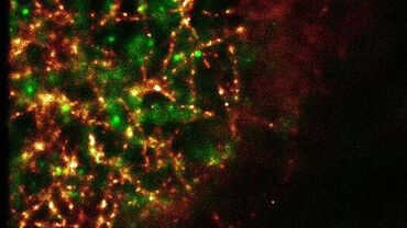 STED 顕微鏡 STELLARIS - アプリケーション | 製品紹介 | Leica Microsystems