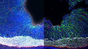 Levi Felts | Learn & Share | Leica Microsystems
