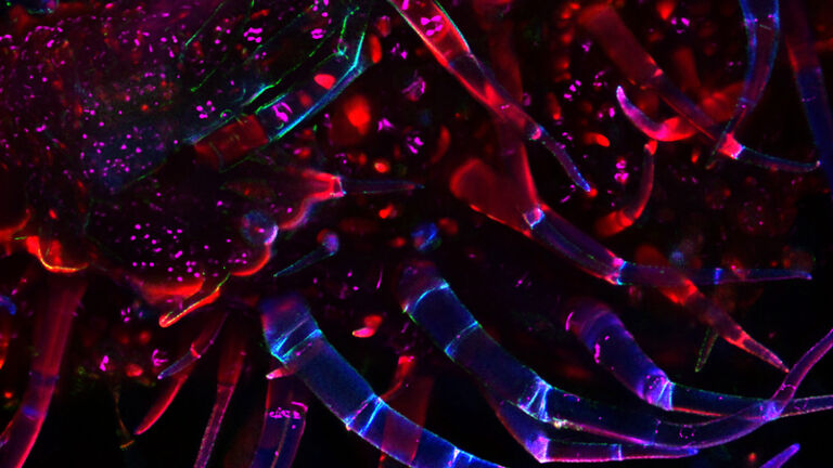 Light Sheet Microscopes | Products | Leica Microsystems
