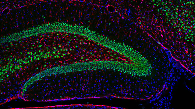 Confocal Microscopes | Products | Leica Microsystems