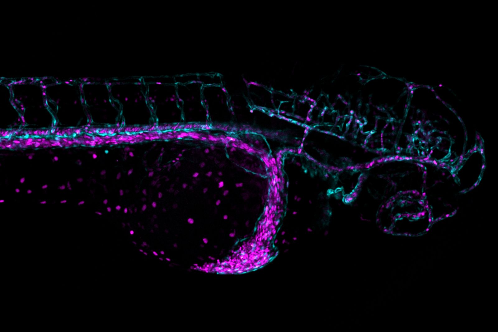 Overcoming Challenges with Microscopy when Imaging Moving Zebrafish ...