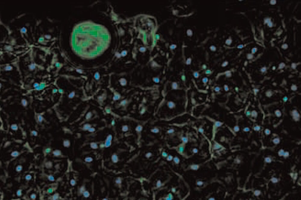 Forensic Detection of Sperm from Sexual Assault Evidence | Learn ...