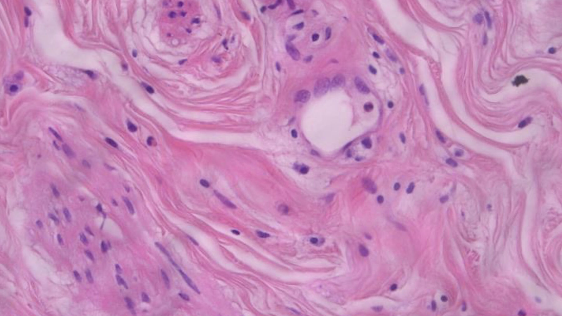 Clinical Pathology | Applications | Leica Microsystems