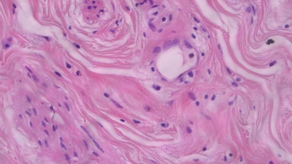 Clinical Pathology | Applications | Leica Microsystems