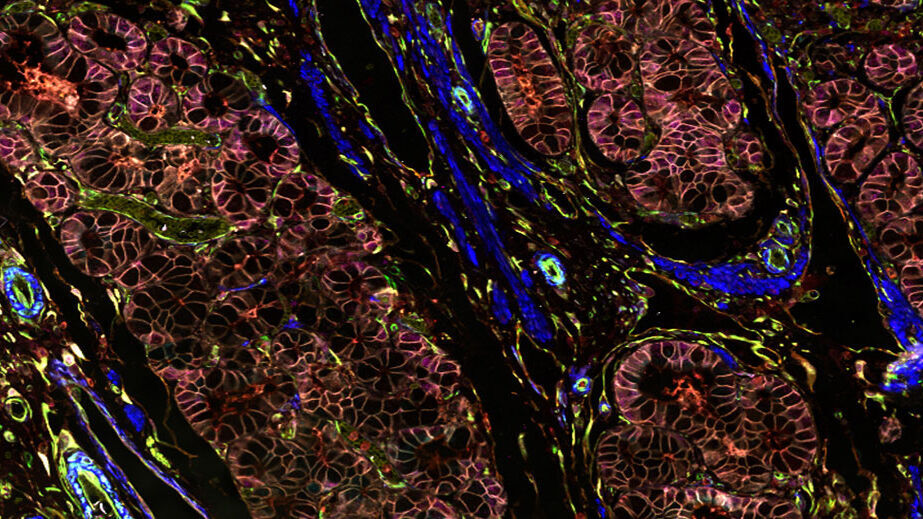 The Importance Of Segmentation In Spatial Biology – JMNG