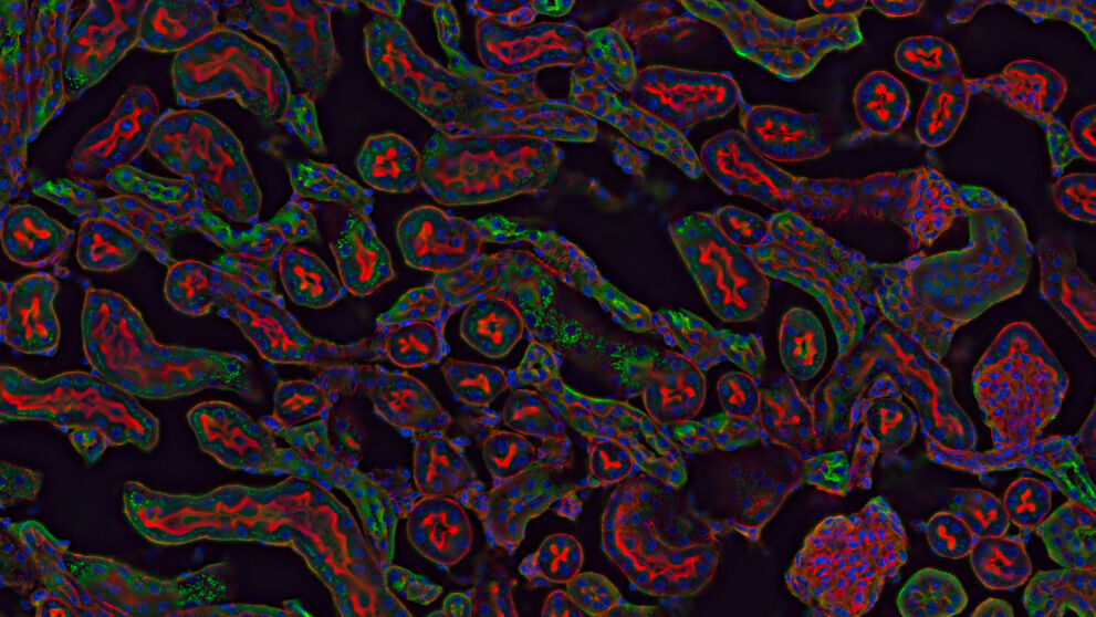 Microscopes DIC | Applications | Leica Microsystems