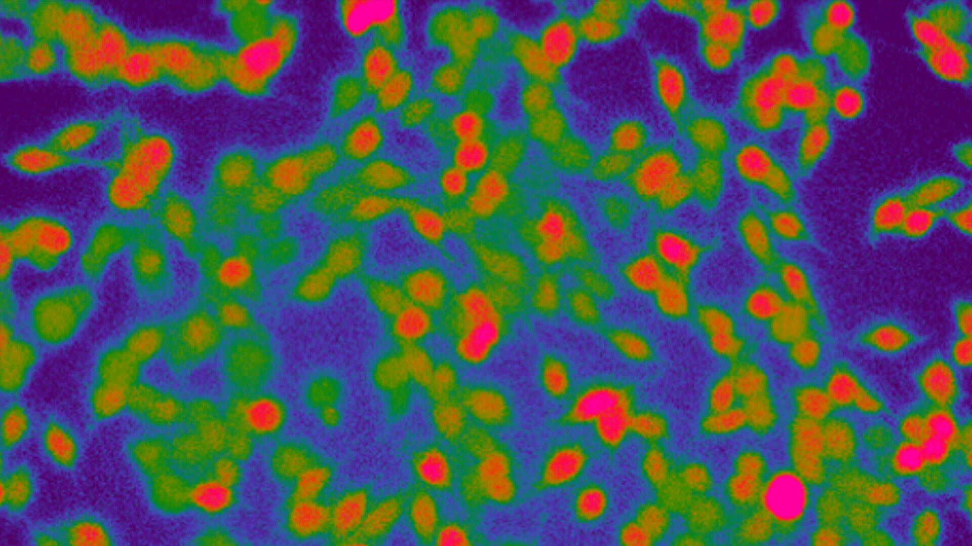 Microscopía correlativa óptica y electrónica (CLEM) | Aplicaciones ...