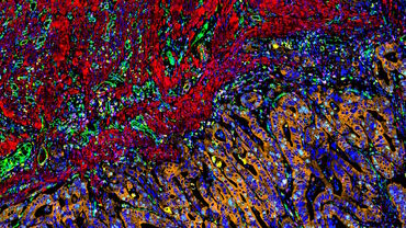 Aivia AI Image Analysis Software - Applications | Products | Leica ...