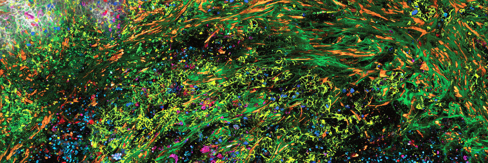 Access 3D high-plex spatial information across scales | Leica Microsystems