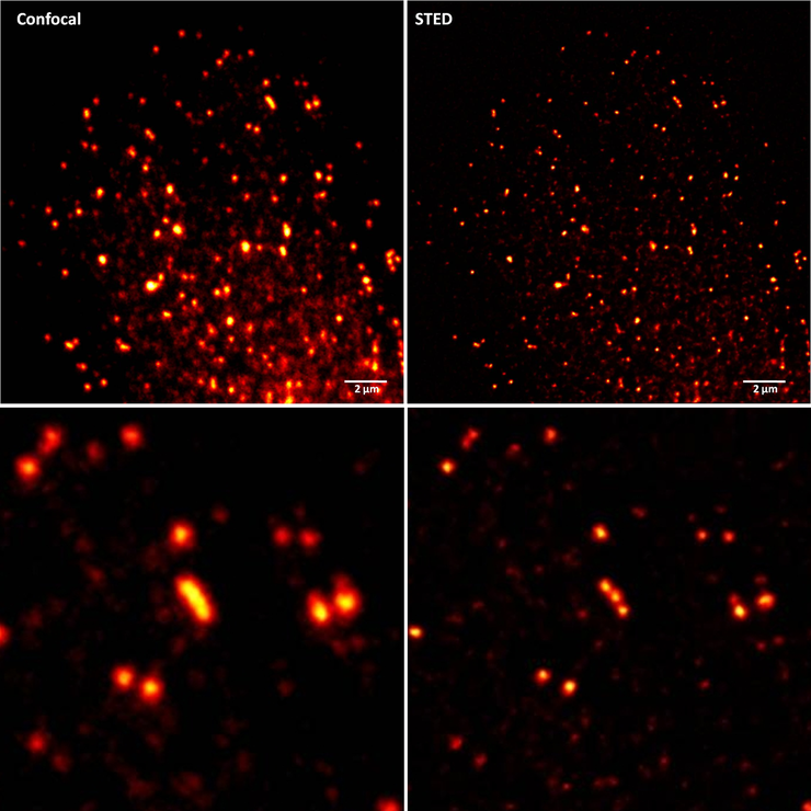 TCS STED The Fast Track to Super-Resolution - Media | Products | Leica ...