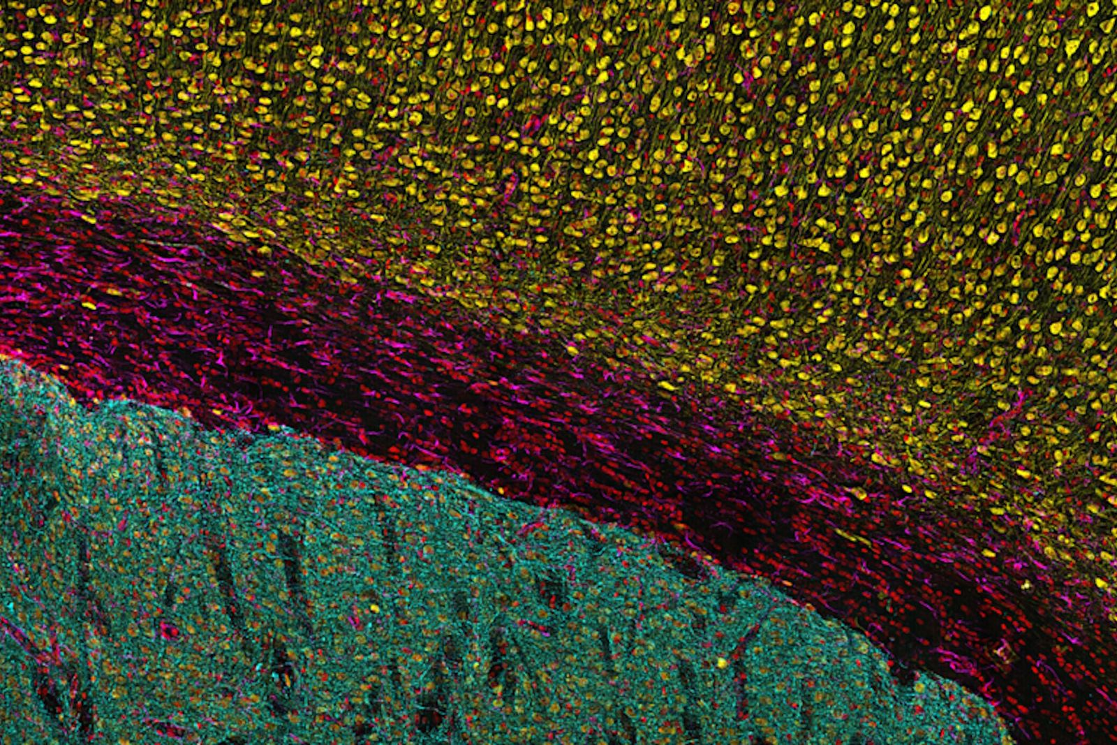 Leica Microsystems Showcases THUNDER Imager Cell Spinning Disk at ...