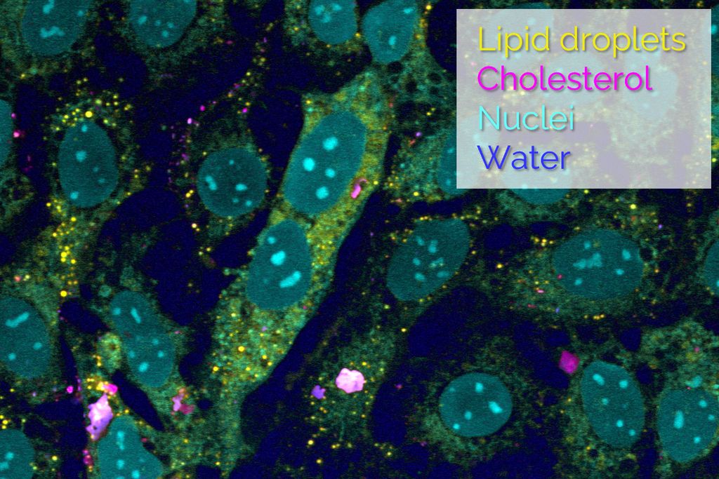 STELLARIS CRS Coherent Raman Scattering Microscope | Products | Leica ...