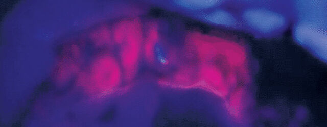 Evolved ARveo 8 Digital Visualization Microscope for Neurosurgery ...