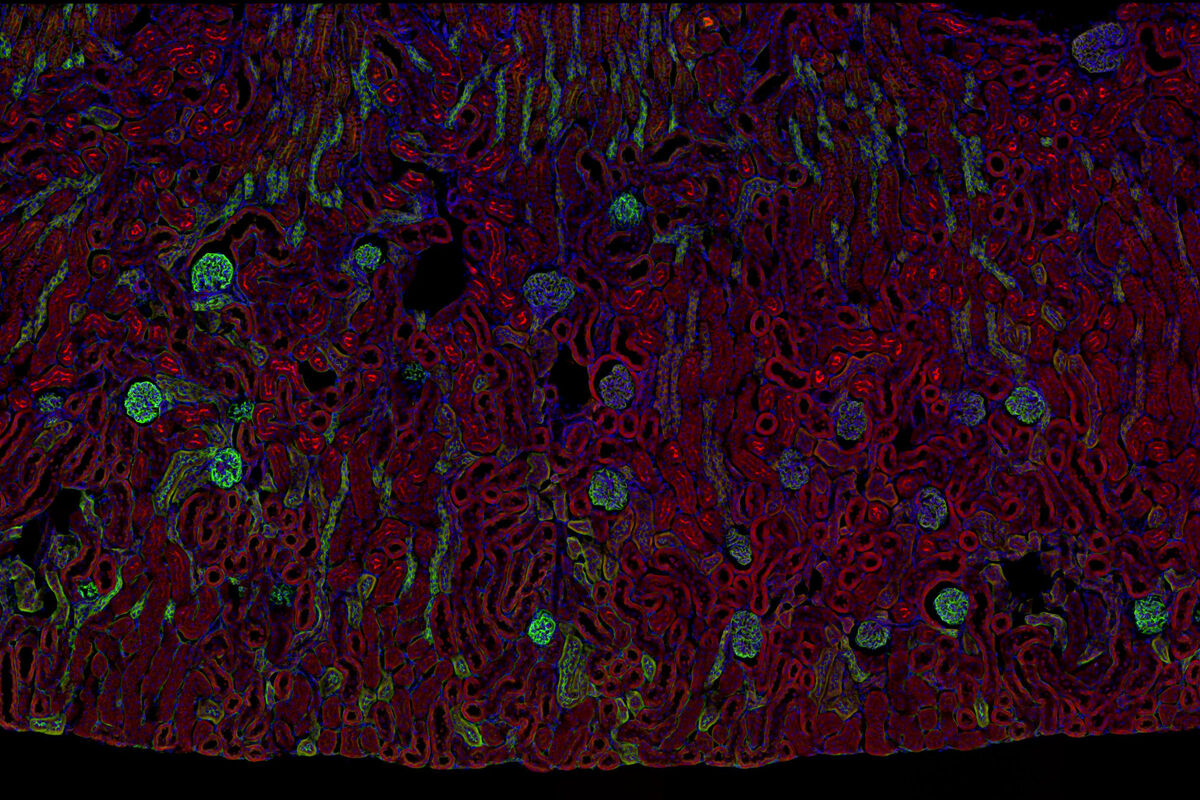 Guide to Microscopy in Cancer Research | Learn & Share | Leica Microsystems