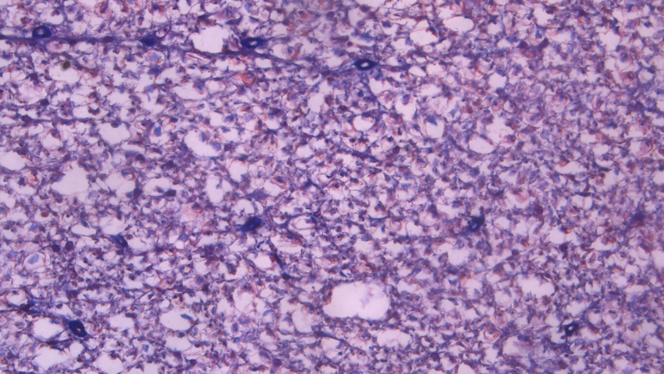 Anatomic Pathology | Applications | Leica Microsystems